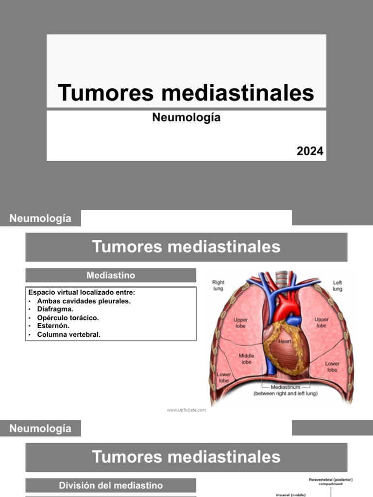 3. Tumores mediastinales | PDF | Neoplasias | Medicina CLINICA