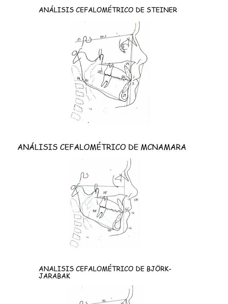 00.1. Ejemplos Cefalometrias | PDF