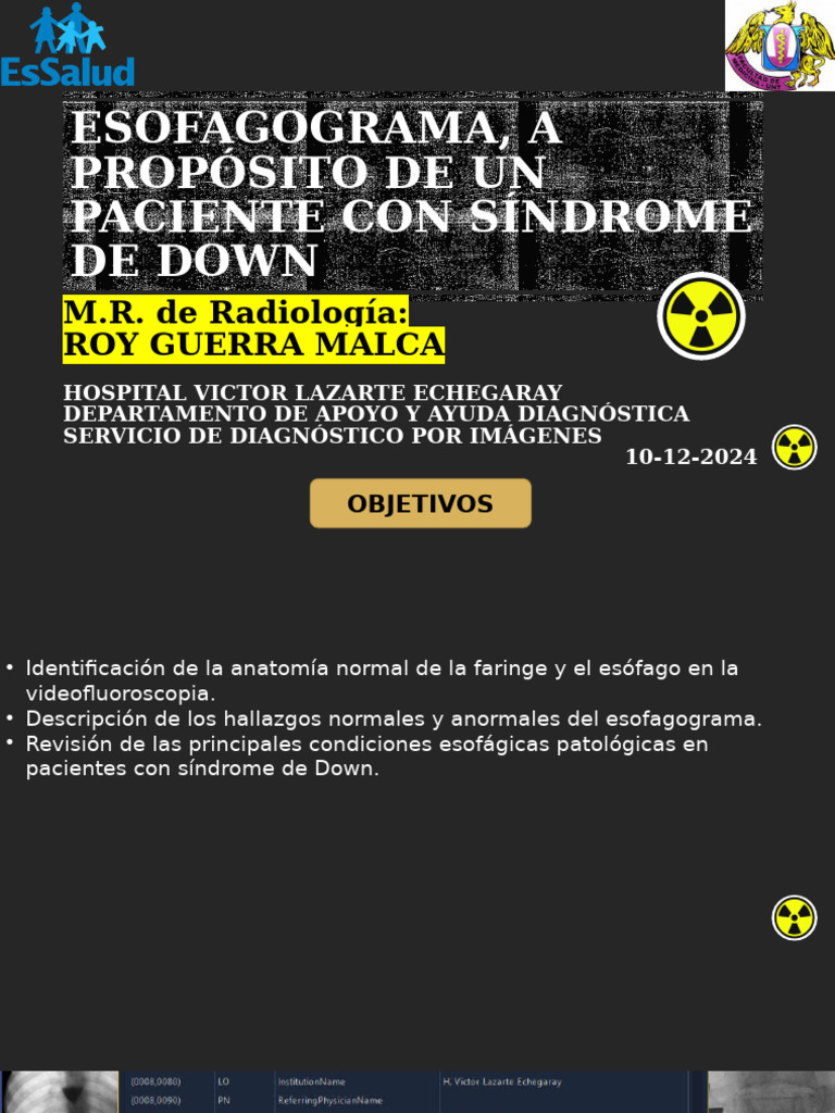 Fluoroscopy Esoph | PDF | Esófago | Sistema digestivo