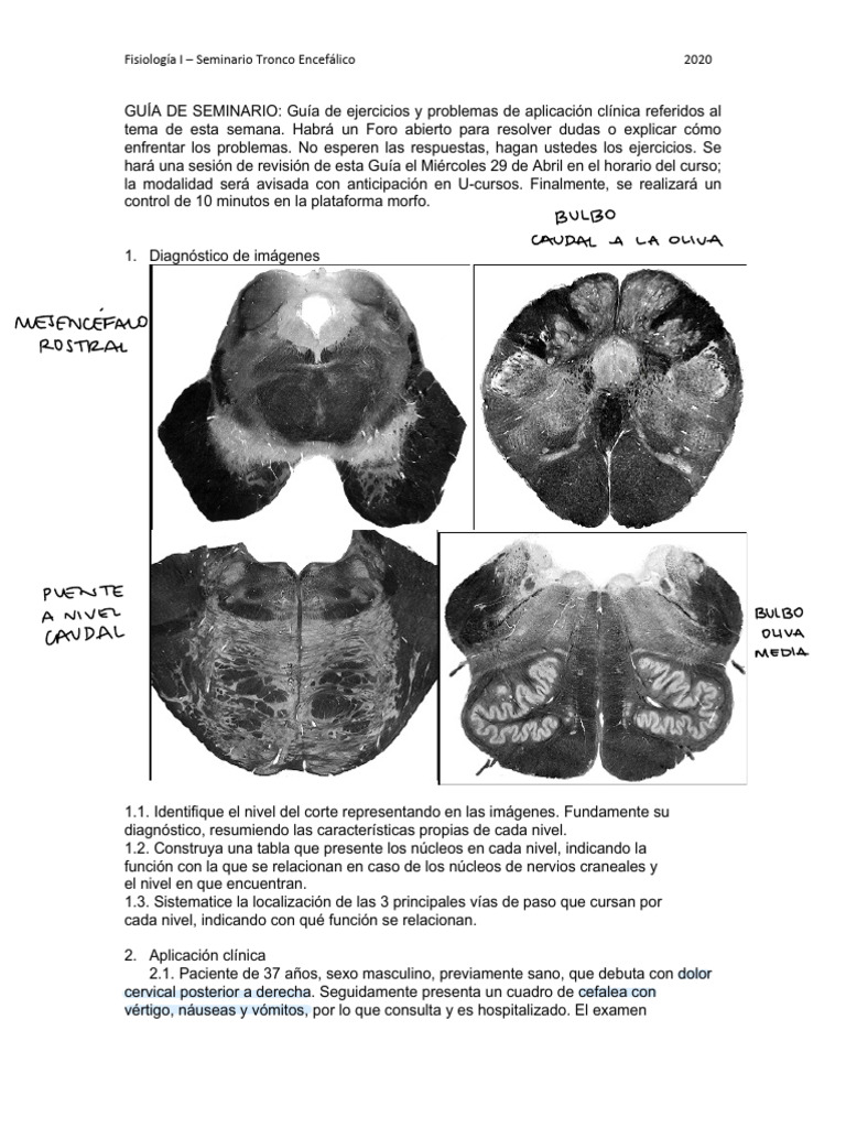 Gu A SEMINARIO Tronco Encef Lico 2020 | PDF | Sistema nervioso | Cerebro