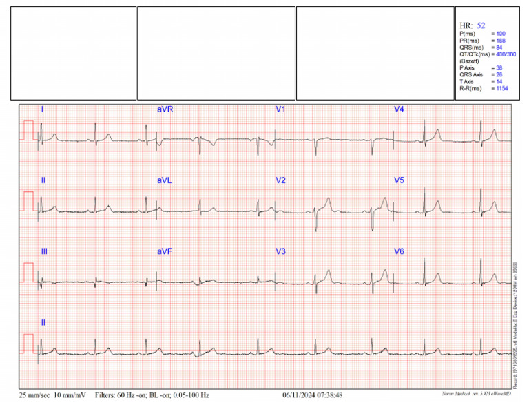 Rodriguezrivera, Luis, Edua 05-10-1988 (36) 06-11-2024 173 85.0 M Sinus ...
