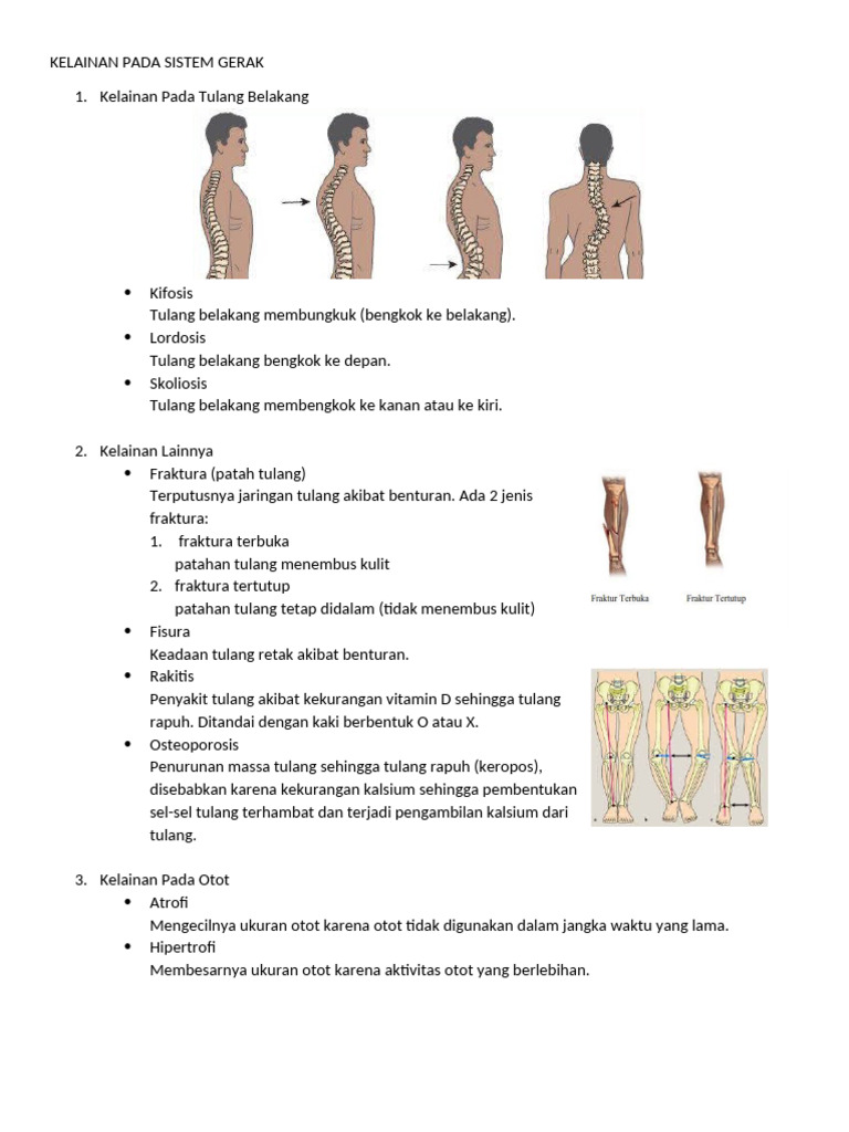 Kelainan Pada Sistem Gerak | PDF