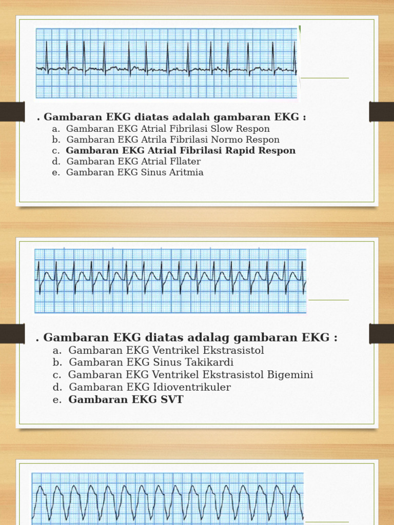 SOAL EKG | PDF