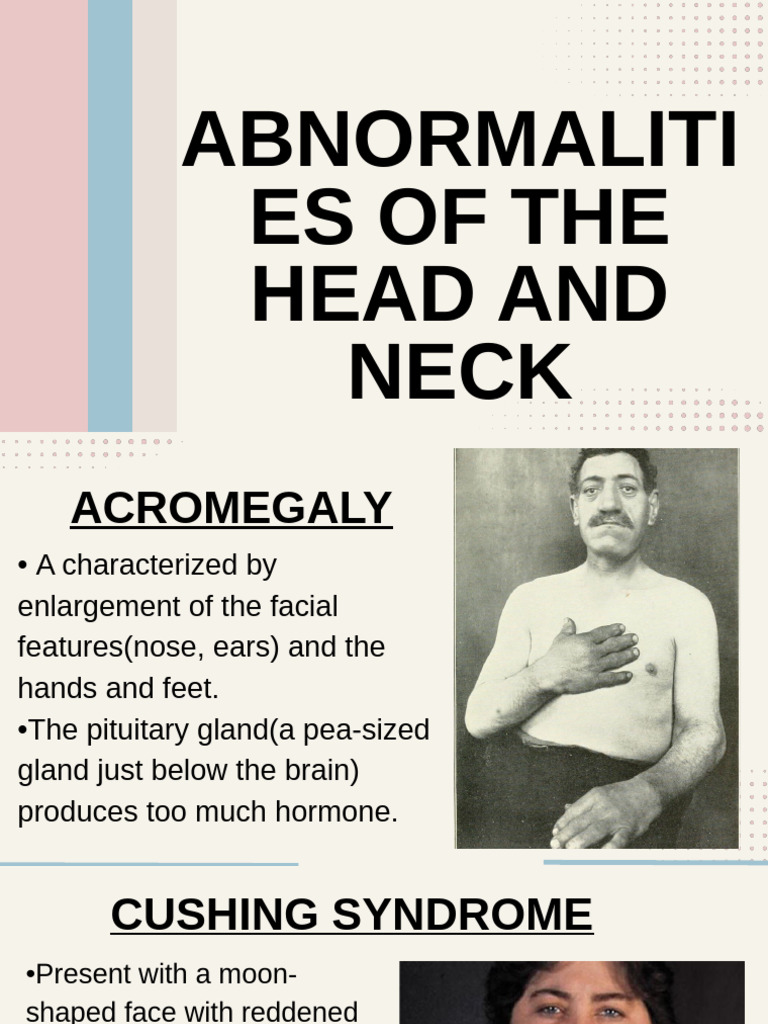 Abnormalities of Head and Neck - 20240304 - 193056 - 0000 | PDF