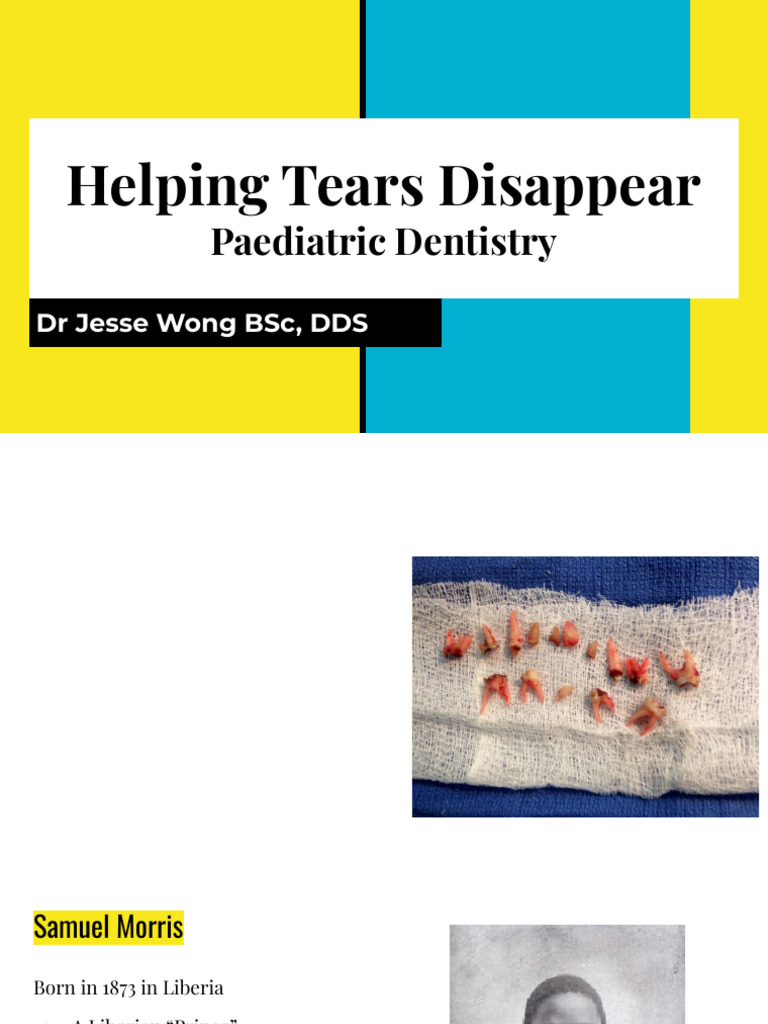 Fiber Reinforced Bridges | PDF | Dental Implant | Dentures