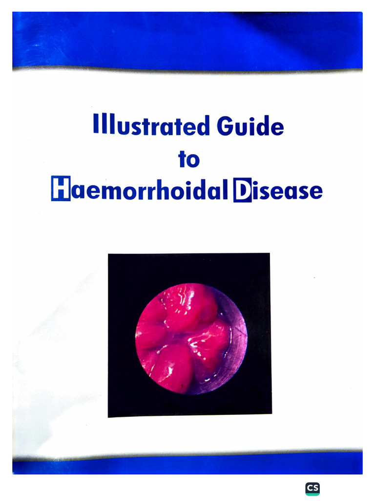 Guide 2 Haemorrhoidal Disease | PDF