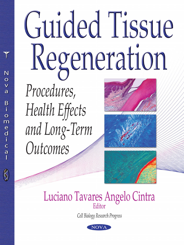 Guided Tissue Regeneration: Procedures, Health Effects and Long-Term ...