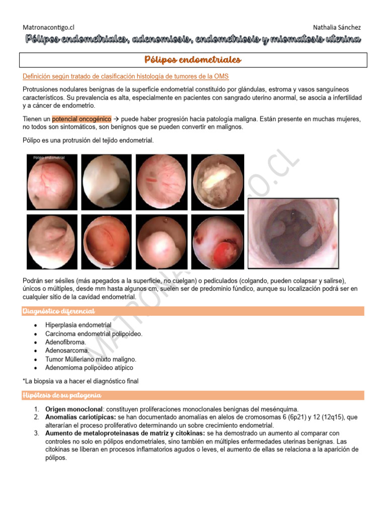 Pólipos Endometriales: Definición y Tratamiento | PDF | Útero | Ginecología