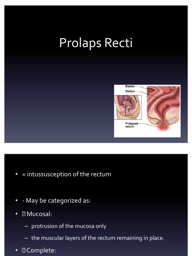 Rectal Prolapse | PDF | Gastroenterology | Digestive System