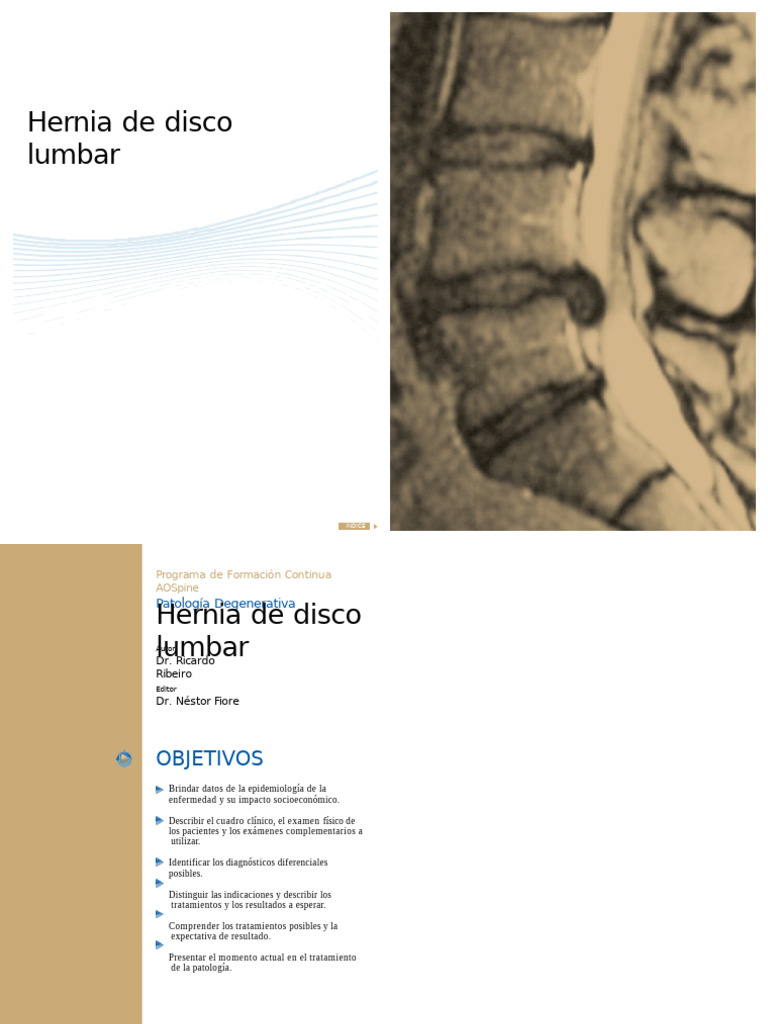 Hernia Discal DR Sosa Raul 2024 LISTO | PDF | Rodilla | Medicina