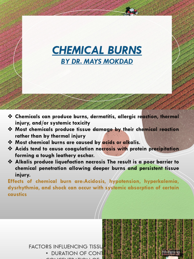 Chemical Burn | PDF | Sodium Hydroxide | Burn