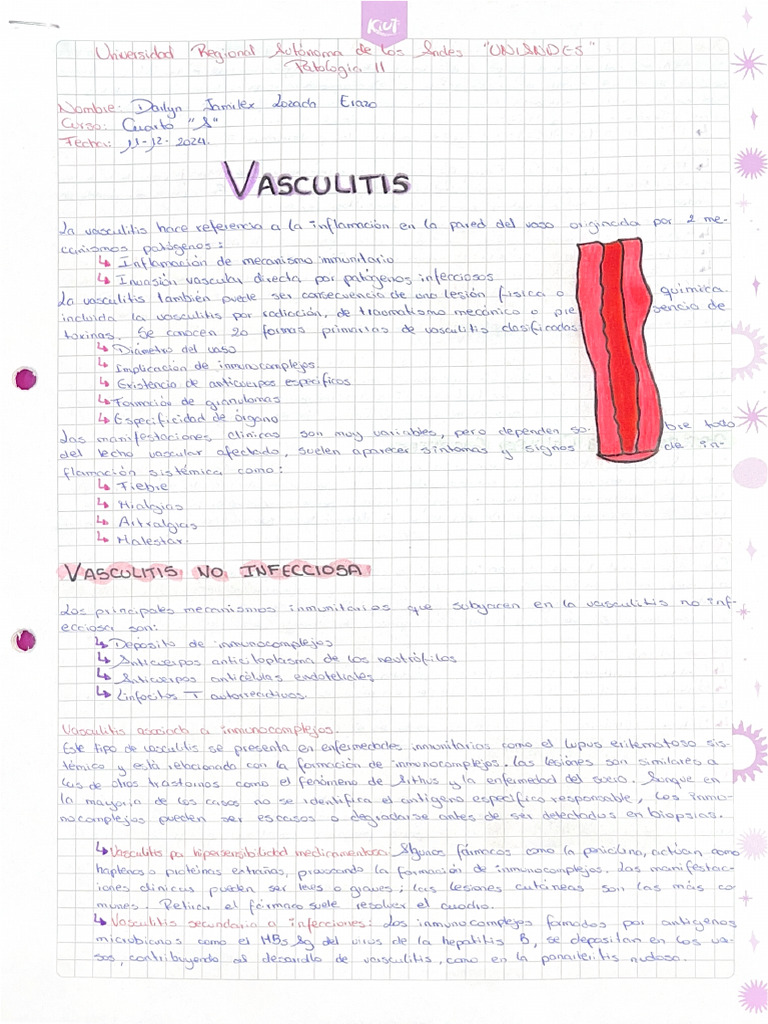Resumen Vasculitis | PDF