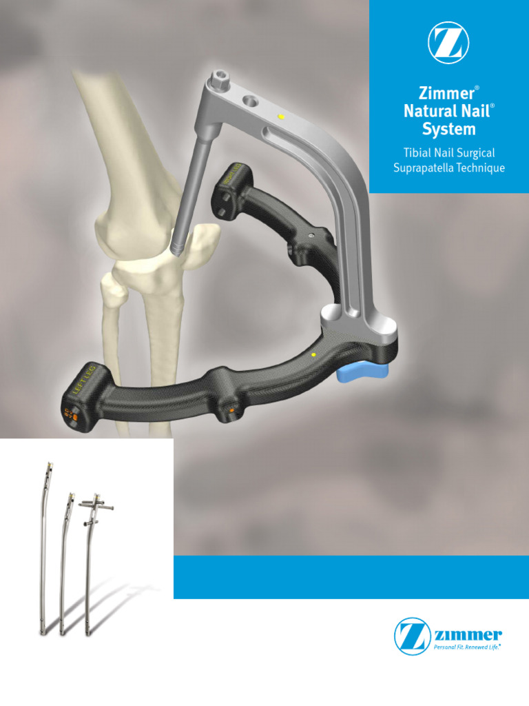 Zimmer Natural Nail System Tibial Nail Surgical Suprapatella Technique ...