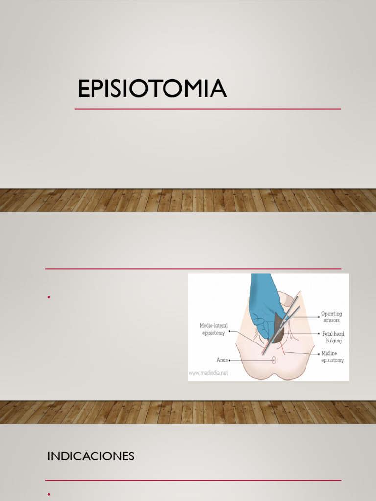 Episiotomia Hgmel | PDF | Parto | Especialidades Medicas