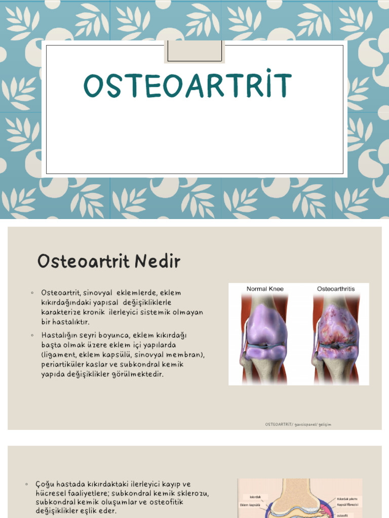 Osteoartrit Sunumu Son | PDF