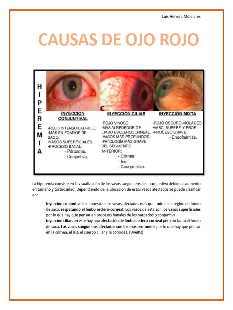 Causas de Ojo Rojo | PDF | Ojo humano | Glaucoma