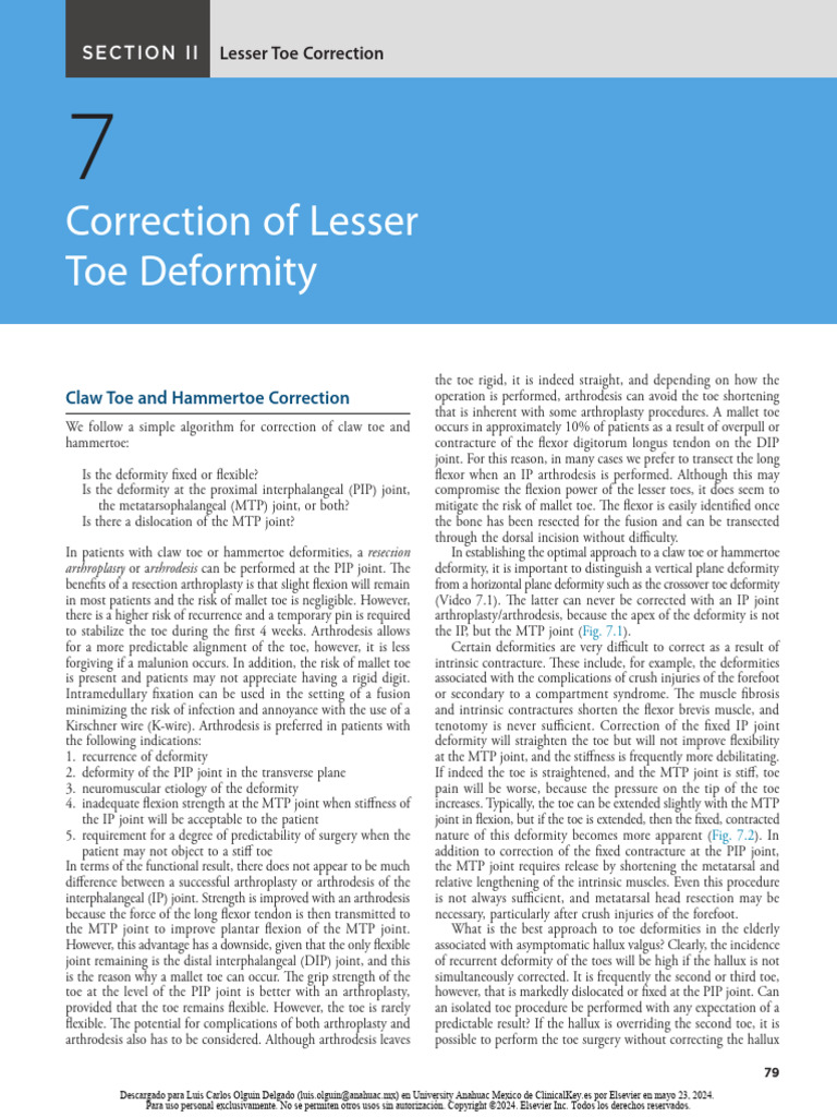 Correction of Lesser Toe Deformity | PDF | Toe | Foot