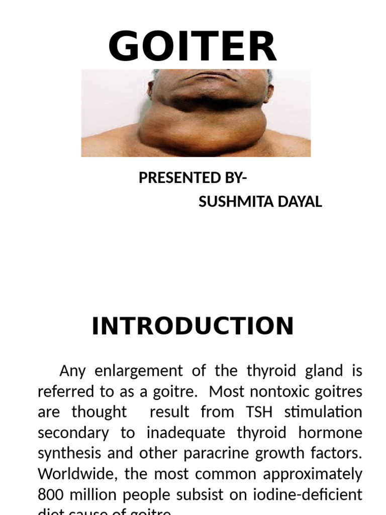 ppt goiter | PDF | Thyroid | Clinical Medicine