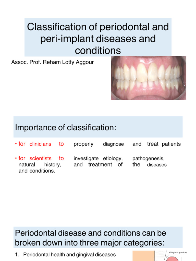 Classification of Periodontal Disease - PPTX - Last Saved by User | PDF ...