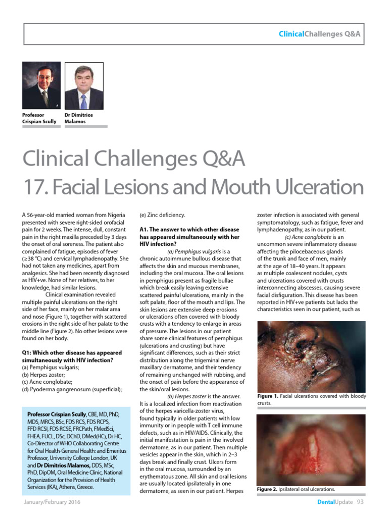 Clinical Challenges Q&A 17. Facial Lesions and Mouth Ulceration | PDF ...