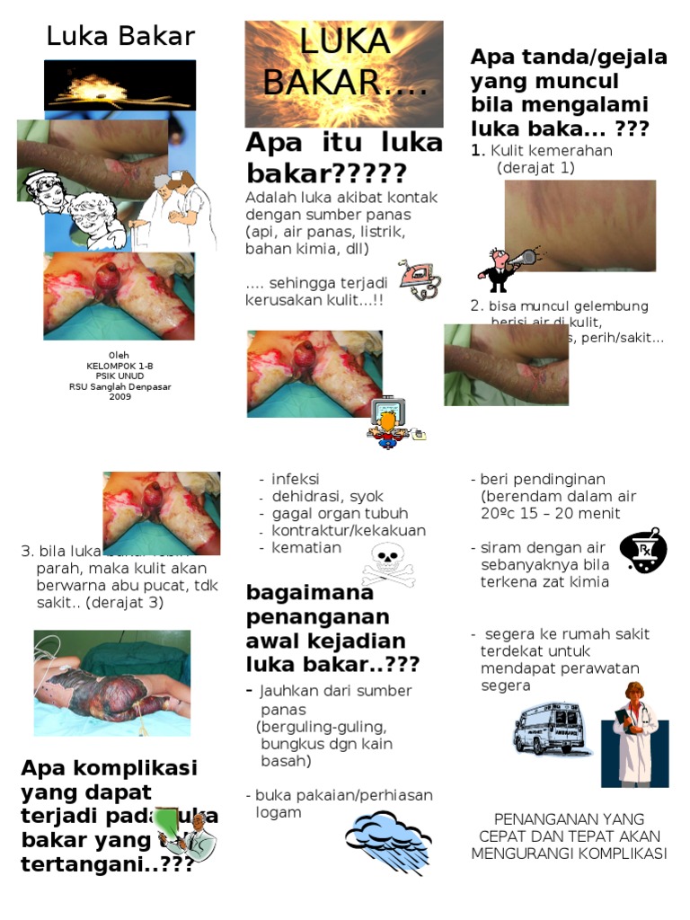 Leaflet Luka Bakar | PDF