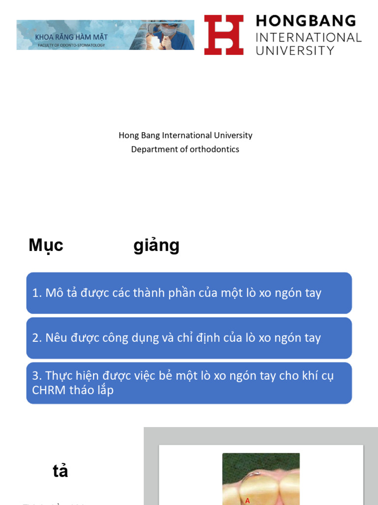 Finger Spring | PDF