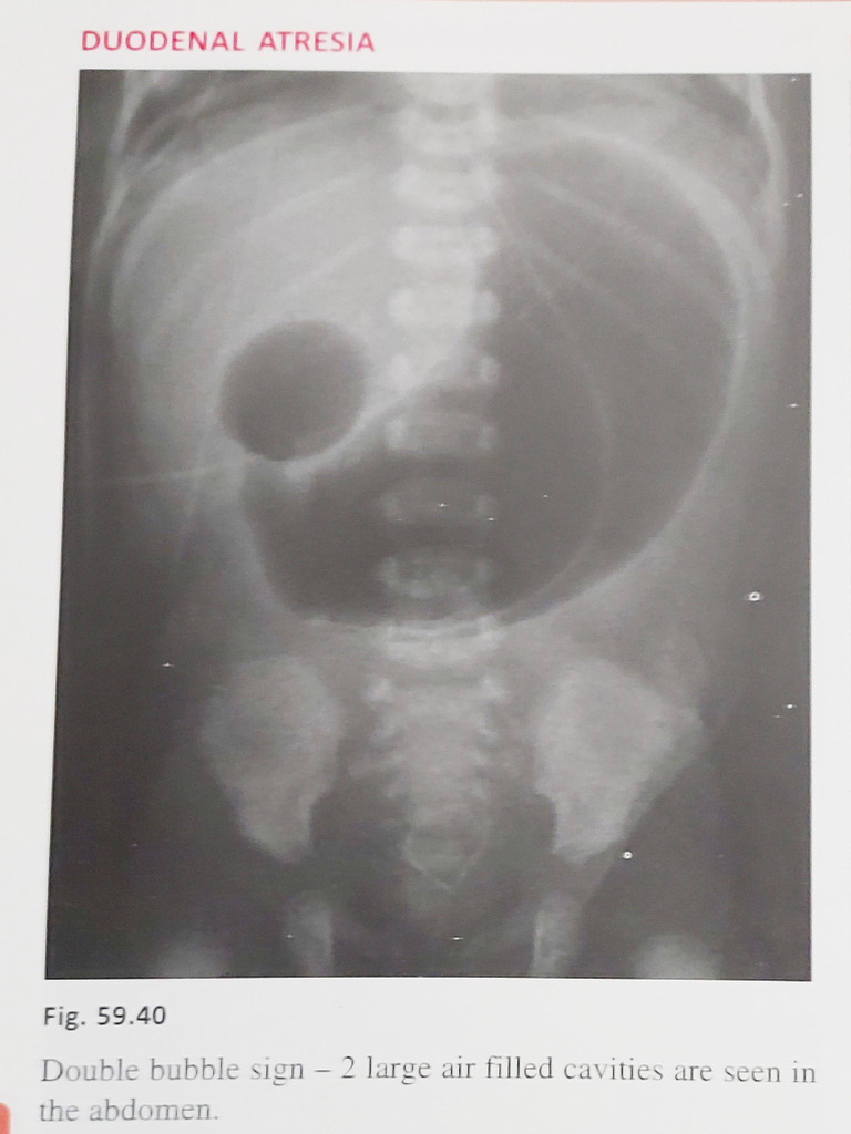 Pediatrics X-Rays | PDF