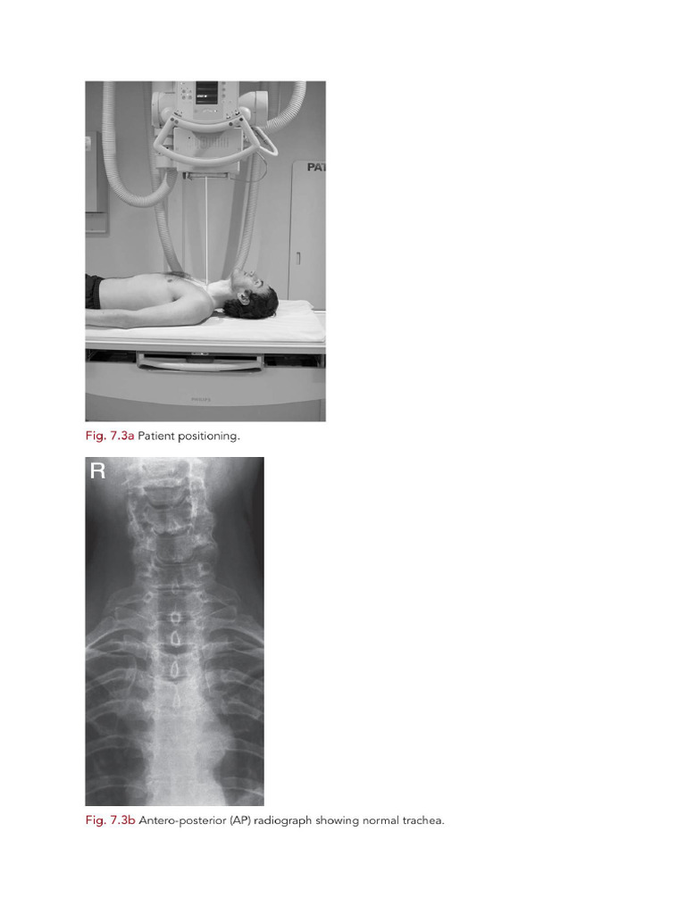 Doc1 Practical | PDF