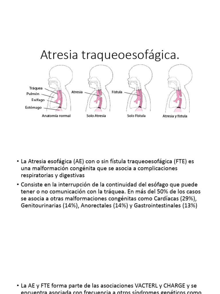 Atresia esofágica: diagnóstico y complicaciones | PDF | Tos ...