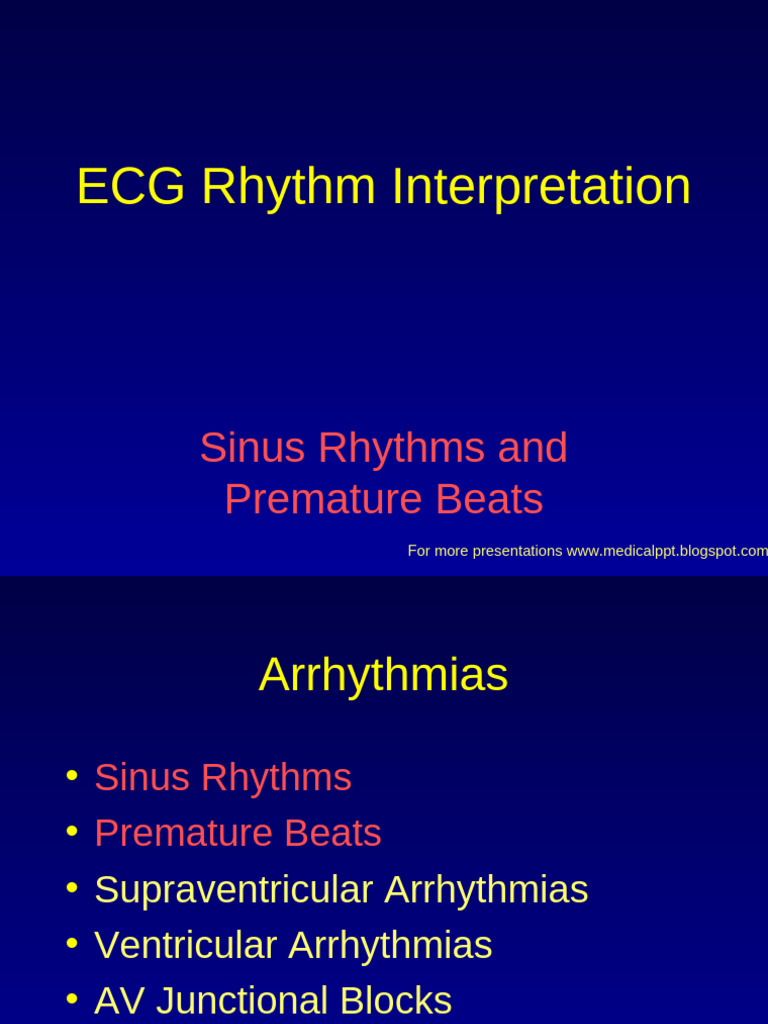 ecg23c | PDF | Electrophysiology | Cardiovascular Diseases