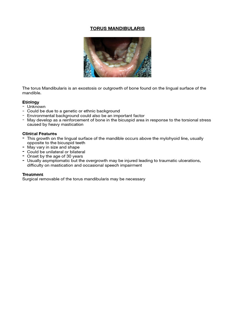 Torus Mandibularis 3 | PDF