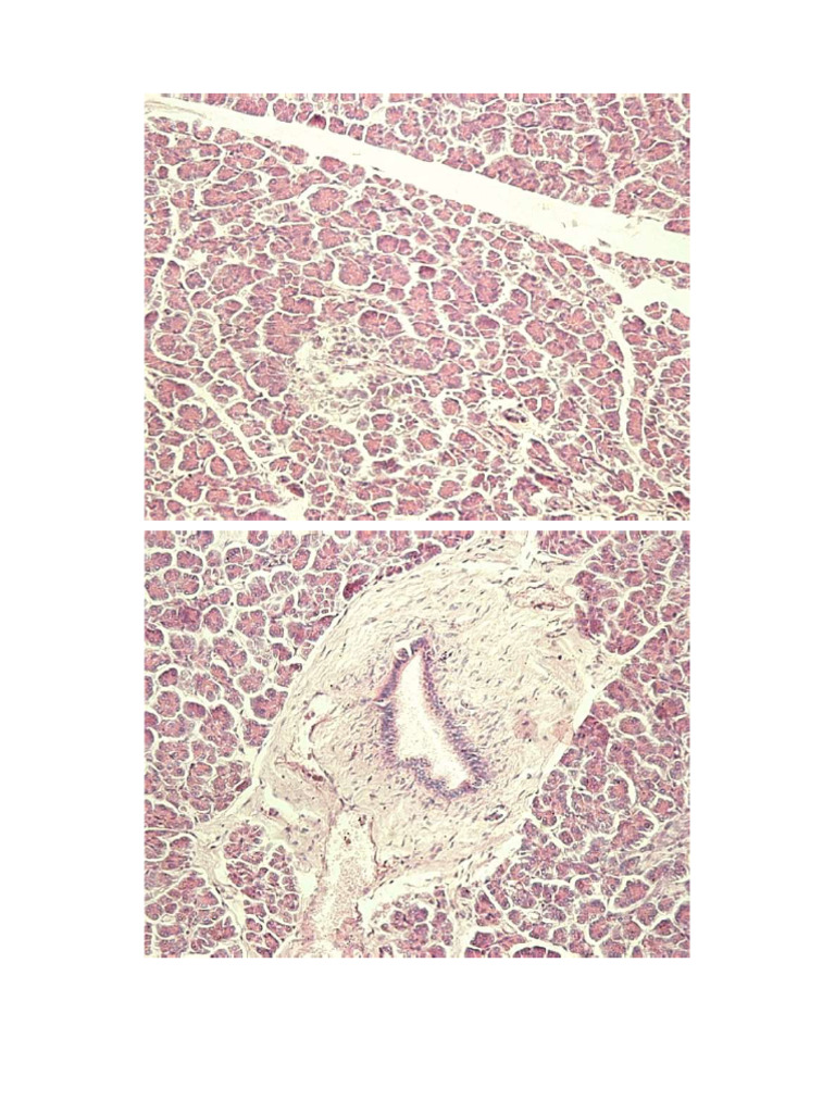 Preparado Pancreas | PDF
