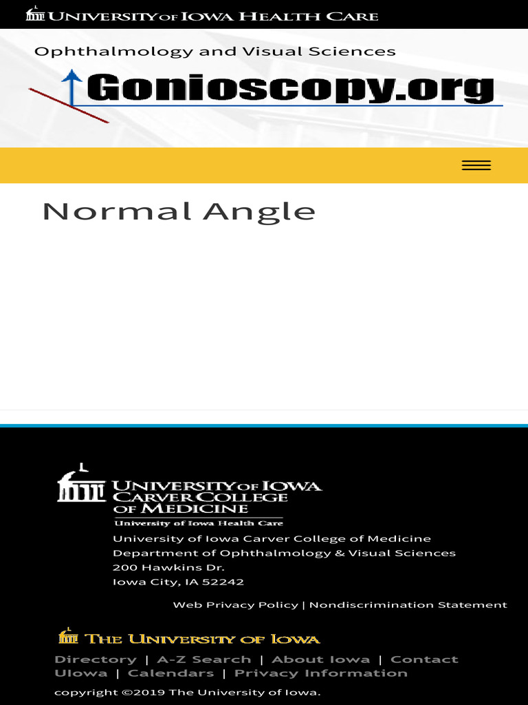 University of Iowa Ophthalmology Info | PDF
