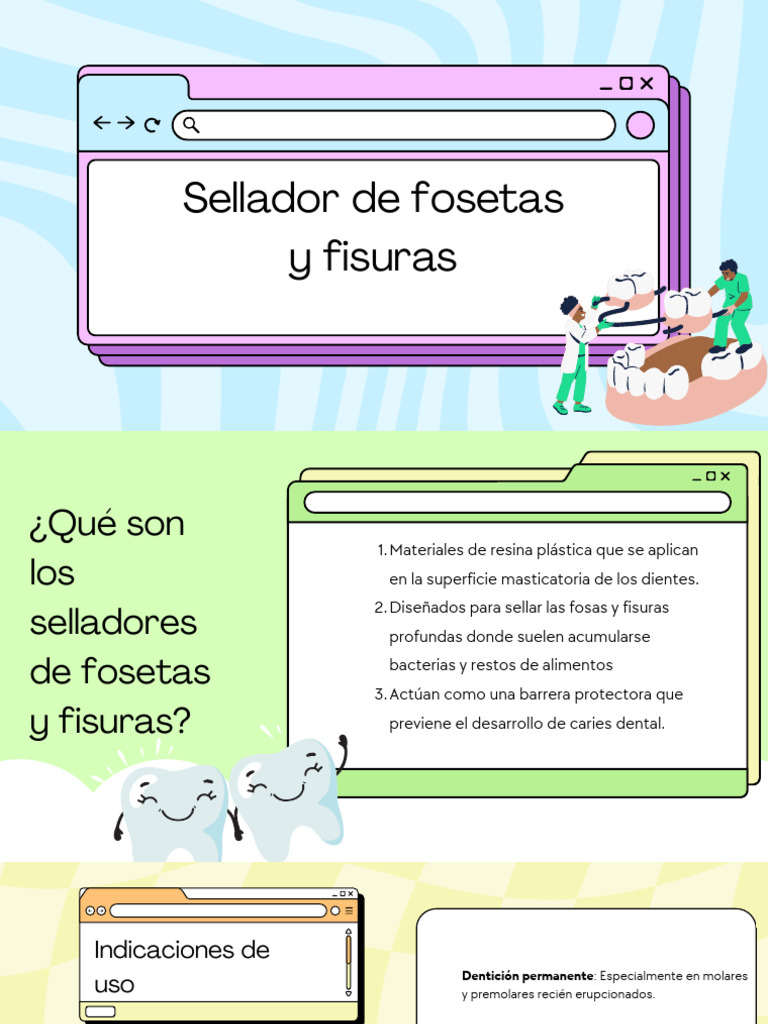 Sellador de Fosetas y Fisuras Odontología | PDF | Diente | Odontología