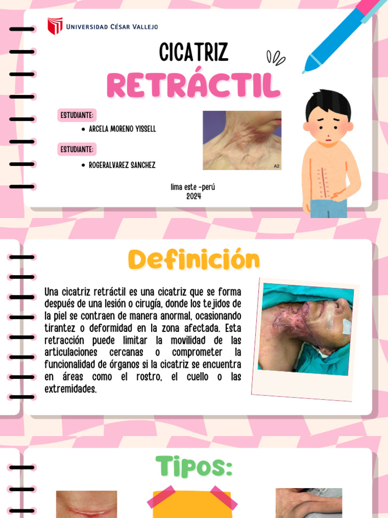 Cicatriz Retráctil | PDF | Cicatriz | Herida