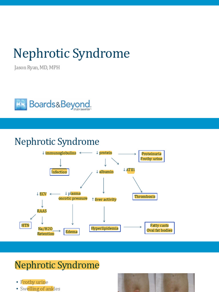 Nephrotic Syndrome Atf | PDF | Causes Of Death | Medical Specialties