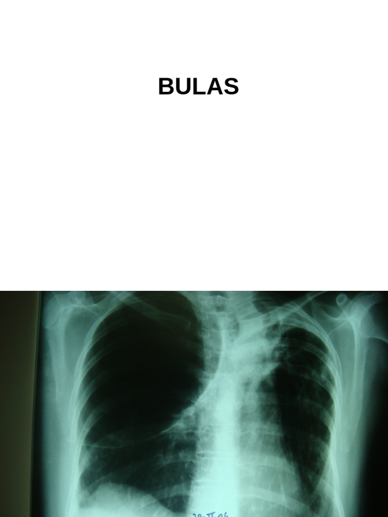 BULAS | PDF
