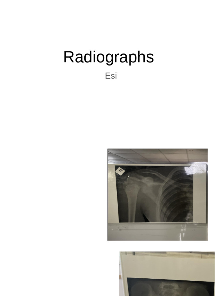 Radiographs | PDF