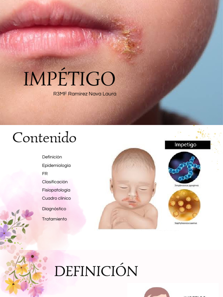 Impétigo | PDF | Inmunología | Medicina