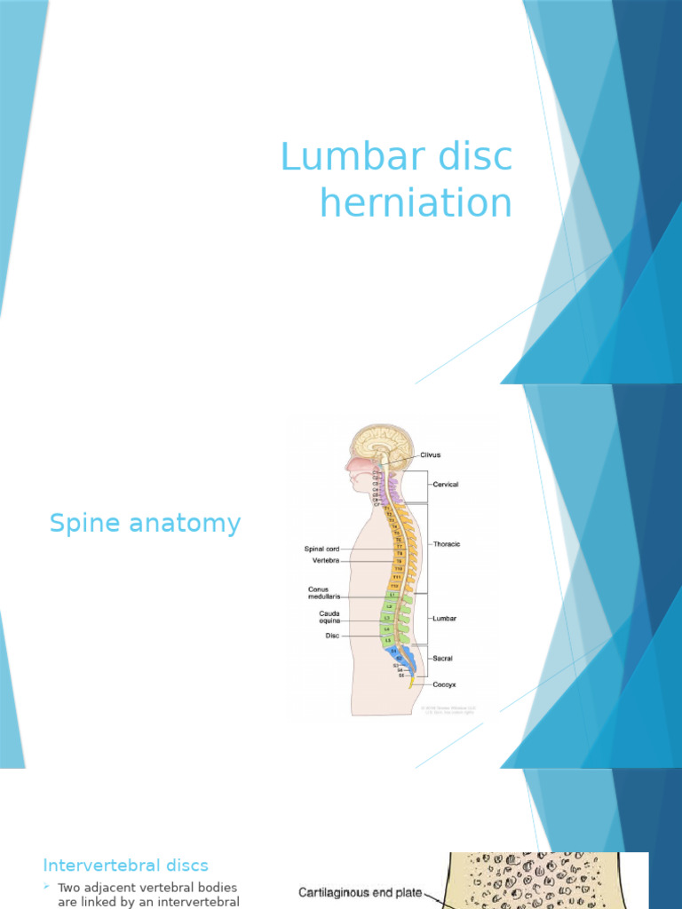 Lumbar Disc Herniation | PDF | Vertebral Column | Back Pain
