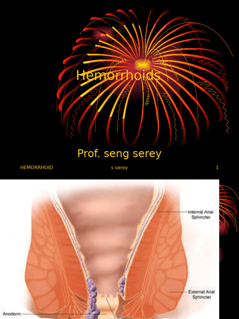 9 Hemorrhoid | PDF | Hemorrhoid | Constipation