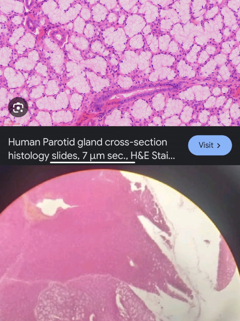 Block 5 Additional Slides Histo | PDF