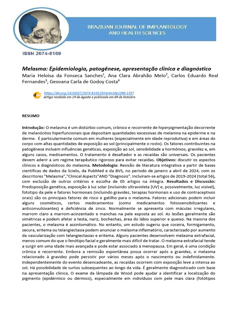 Melasma: Epidemiologia, Patogênese, Apresentação Clínica e Diagnóstico ...