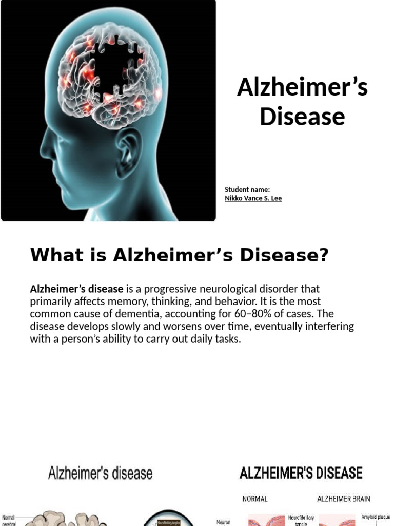 Nikko Vance S. Lee n115 Report | PDF | Alzheimer's Disease | Amyloid Beta