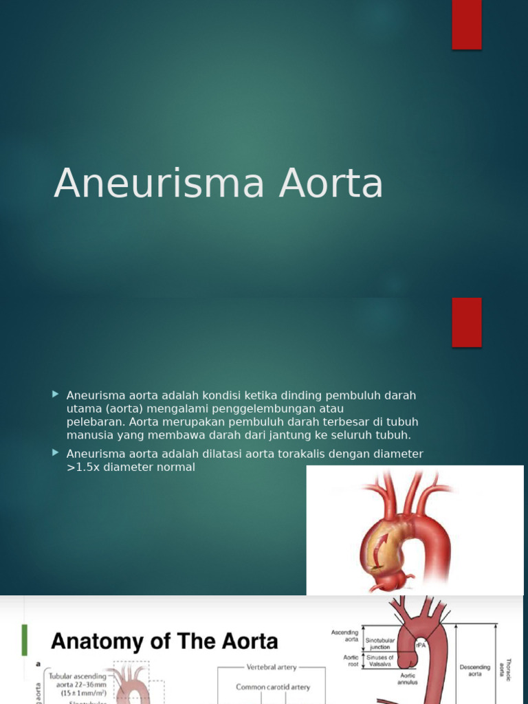 Aneurisma Aorta | PDF