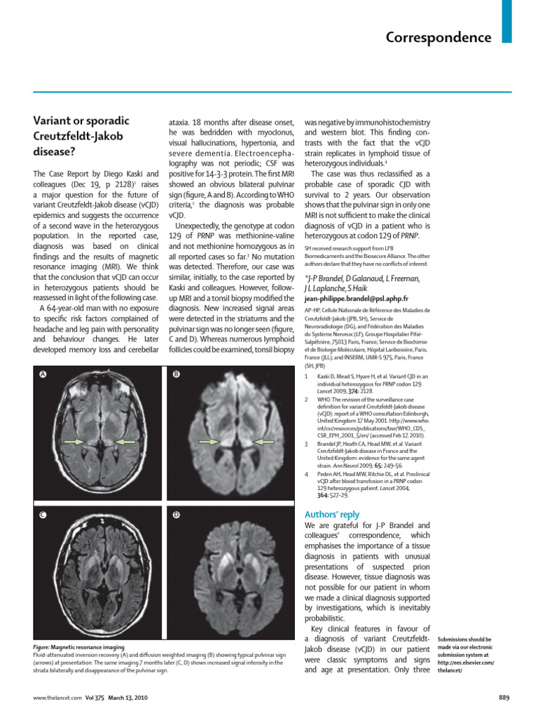 Variant or Sporadic Creutzfeldt Jakob Disease | PDF | Clinical Medicine ...