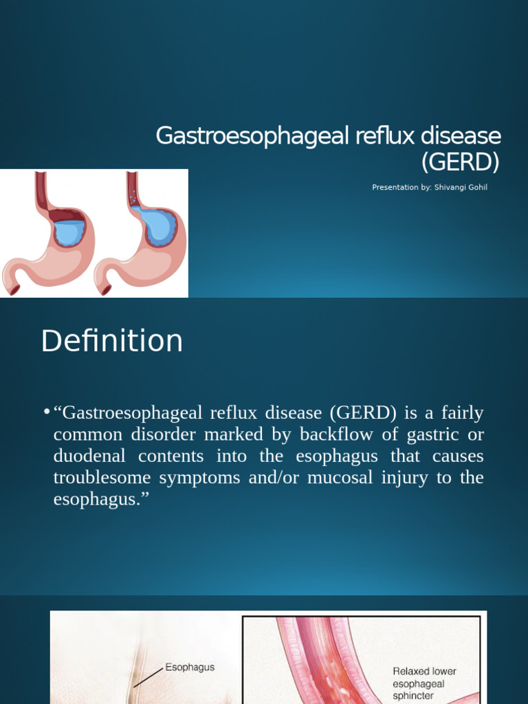 Gastroesophageal Reflux Disease (GERD) JG | PDF | Gastroesophageal ...