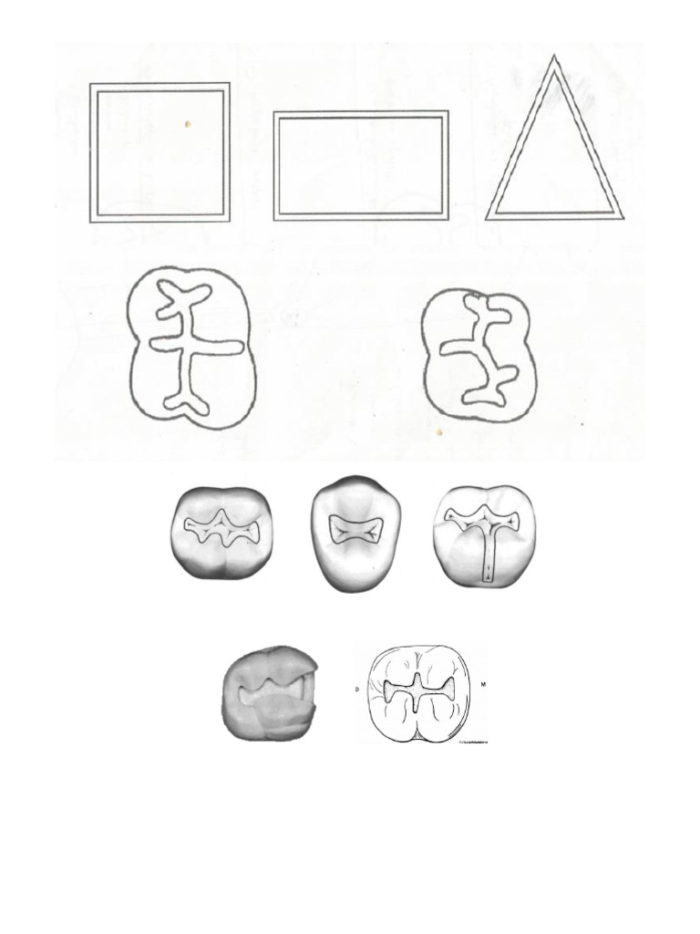 Indirect Vision Practice | PDF