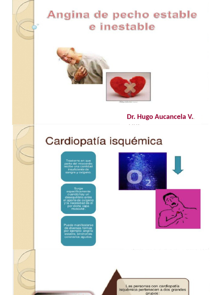 ANGINA ESTABLE E INESTABLE I 21 | PDF