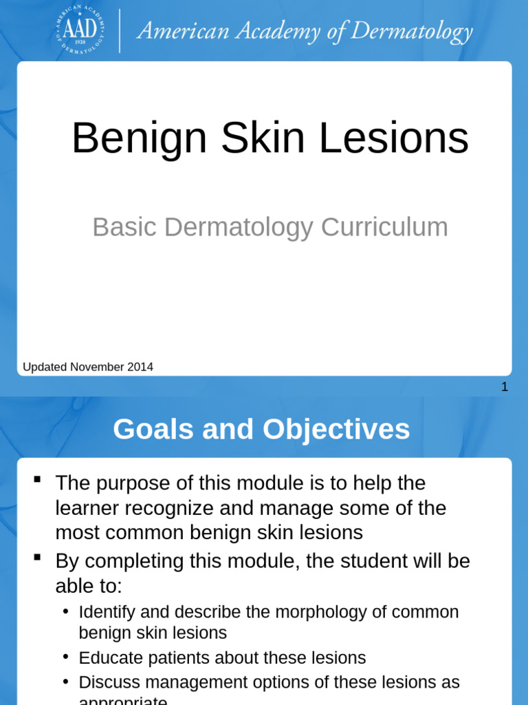 Benign Skin Lesions | PDF | Skin | Medical Specialties